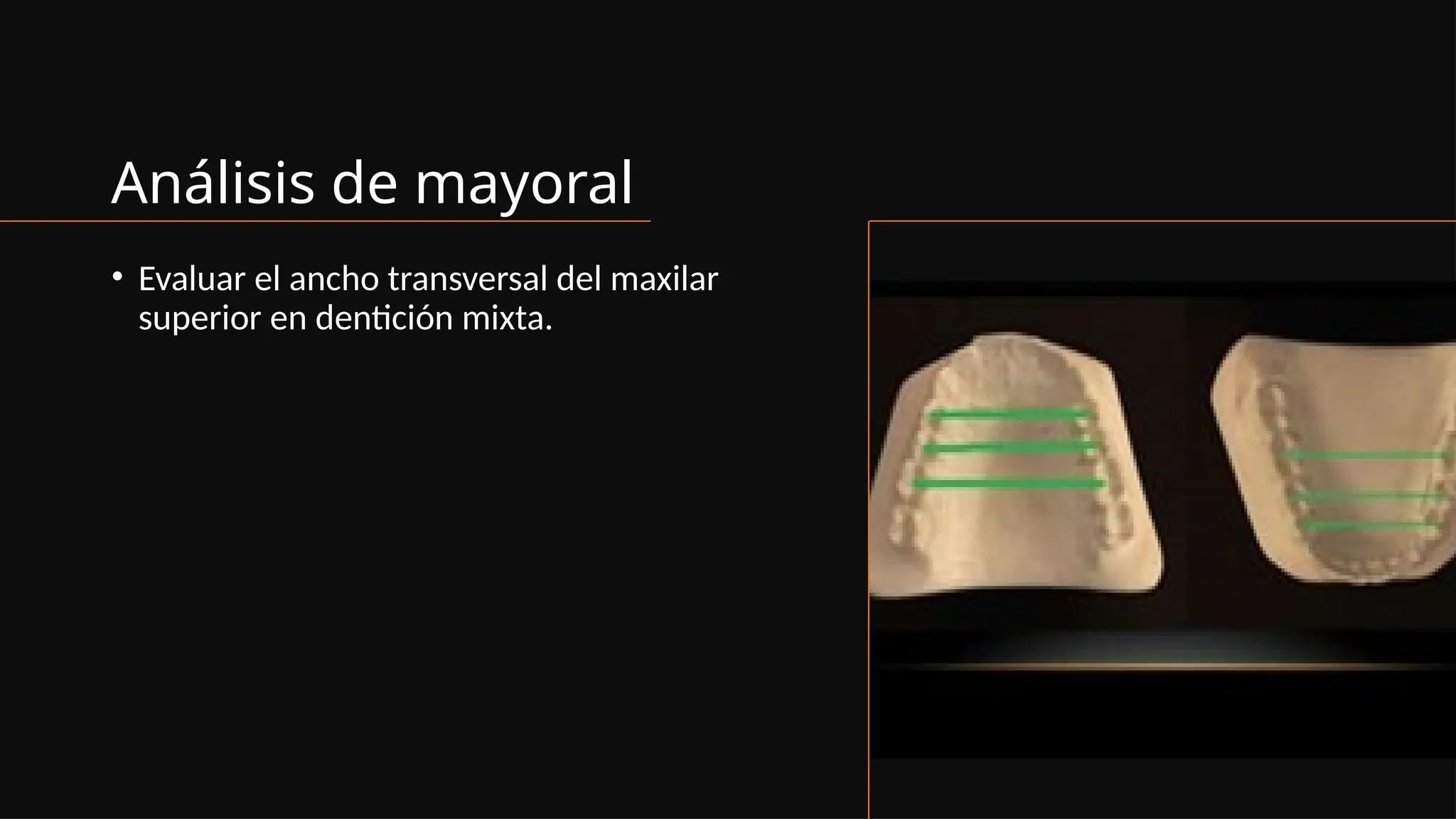 Análisis de modelo de estudio de moyers y mayoral | PPTX