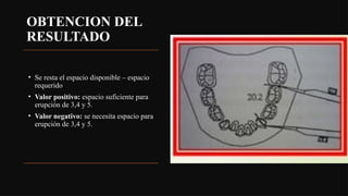 Análisis de modelo de estudio de moyers y mayoral | PPTX
