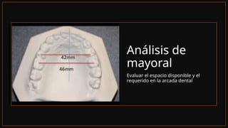 Análisis de modelo de estudio de moyers y mayoral | PPTX
