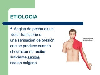 angina de pecho | PPT