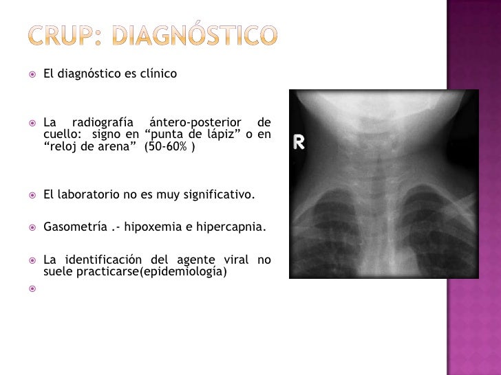 Presentacin crup 1