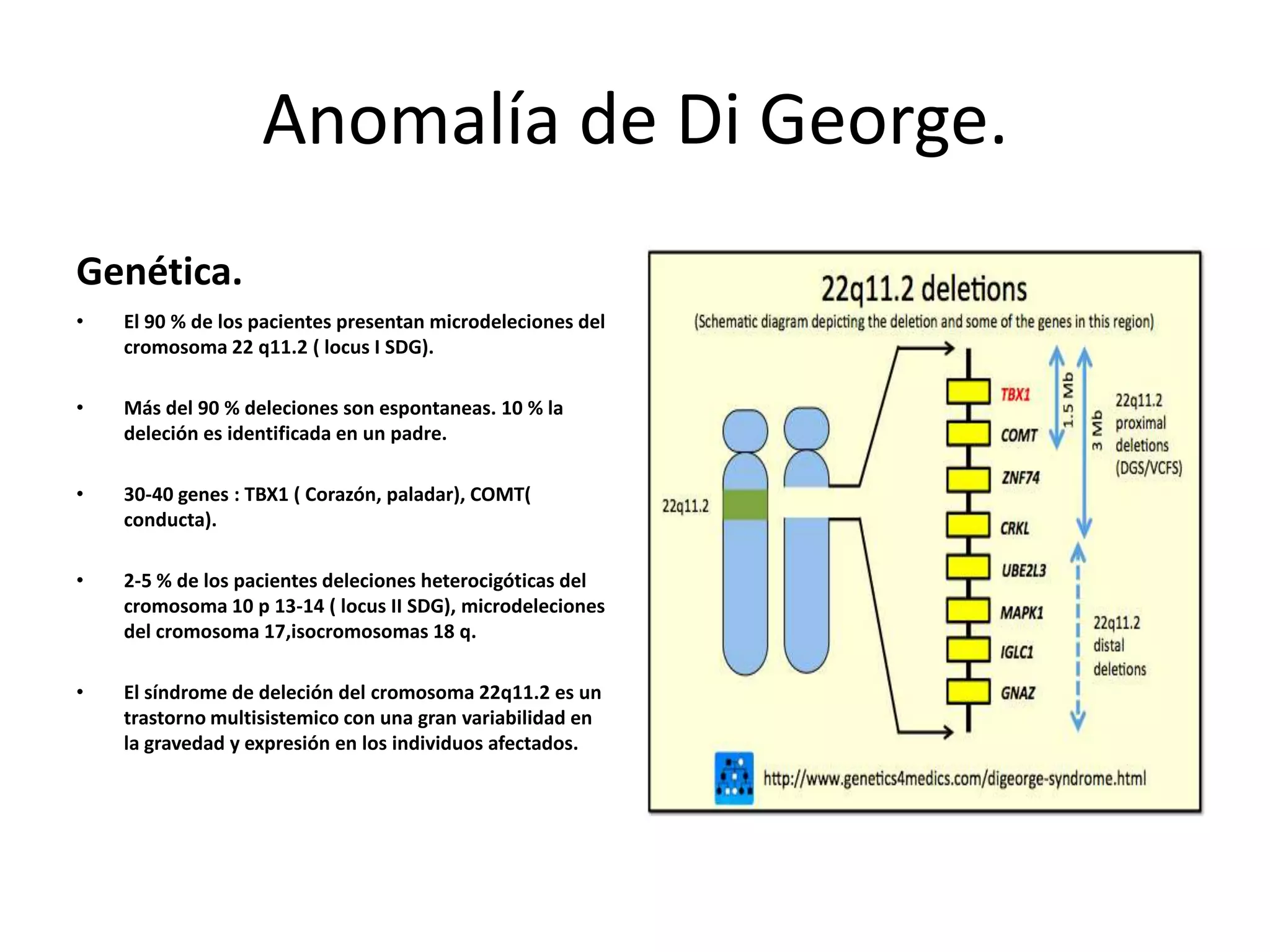 Manejo de la anomalía de di george