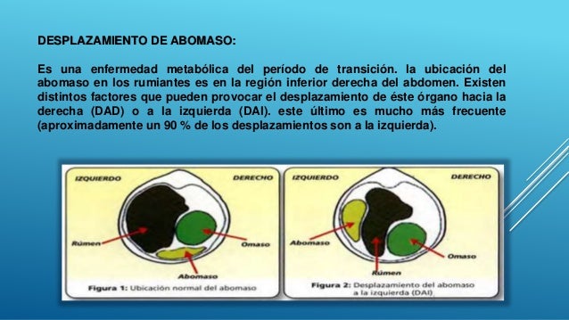 Presentación desplazamiento de abomaso