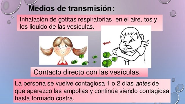 Presentación de varicela