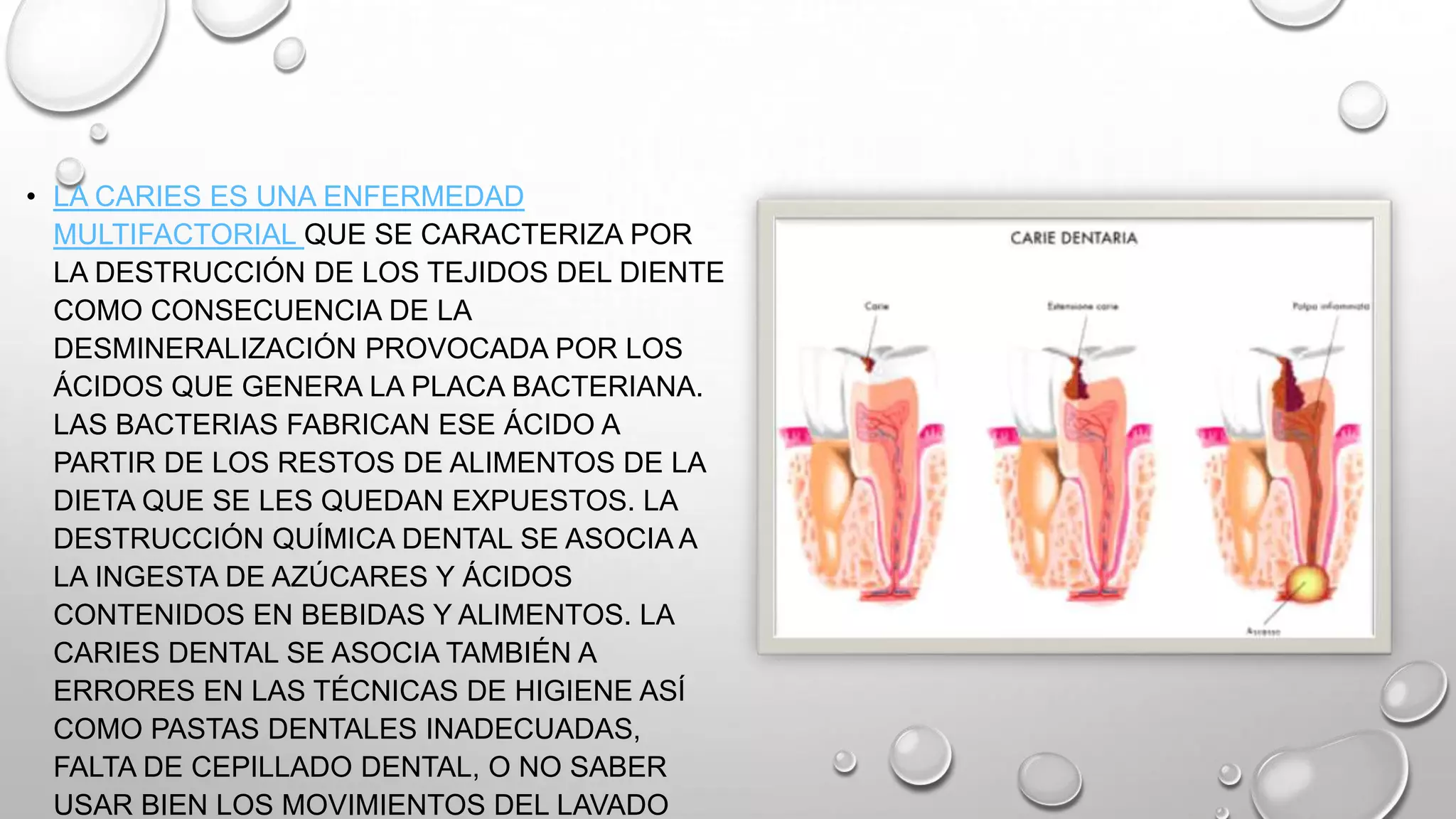 Caries dental | PPTX