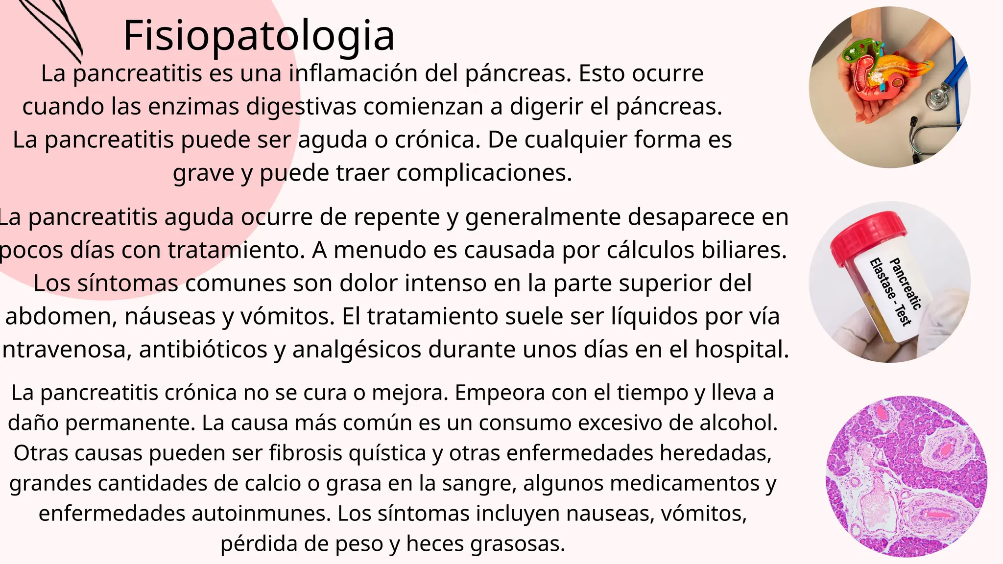 Ppancretitits enfermeria una descripcion | PPTX