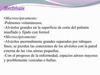 Presentación epoc | PPTX