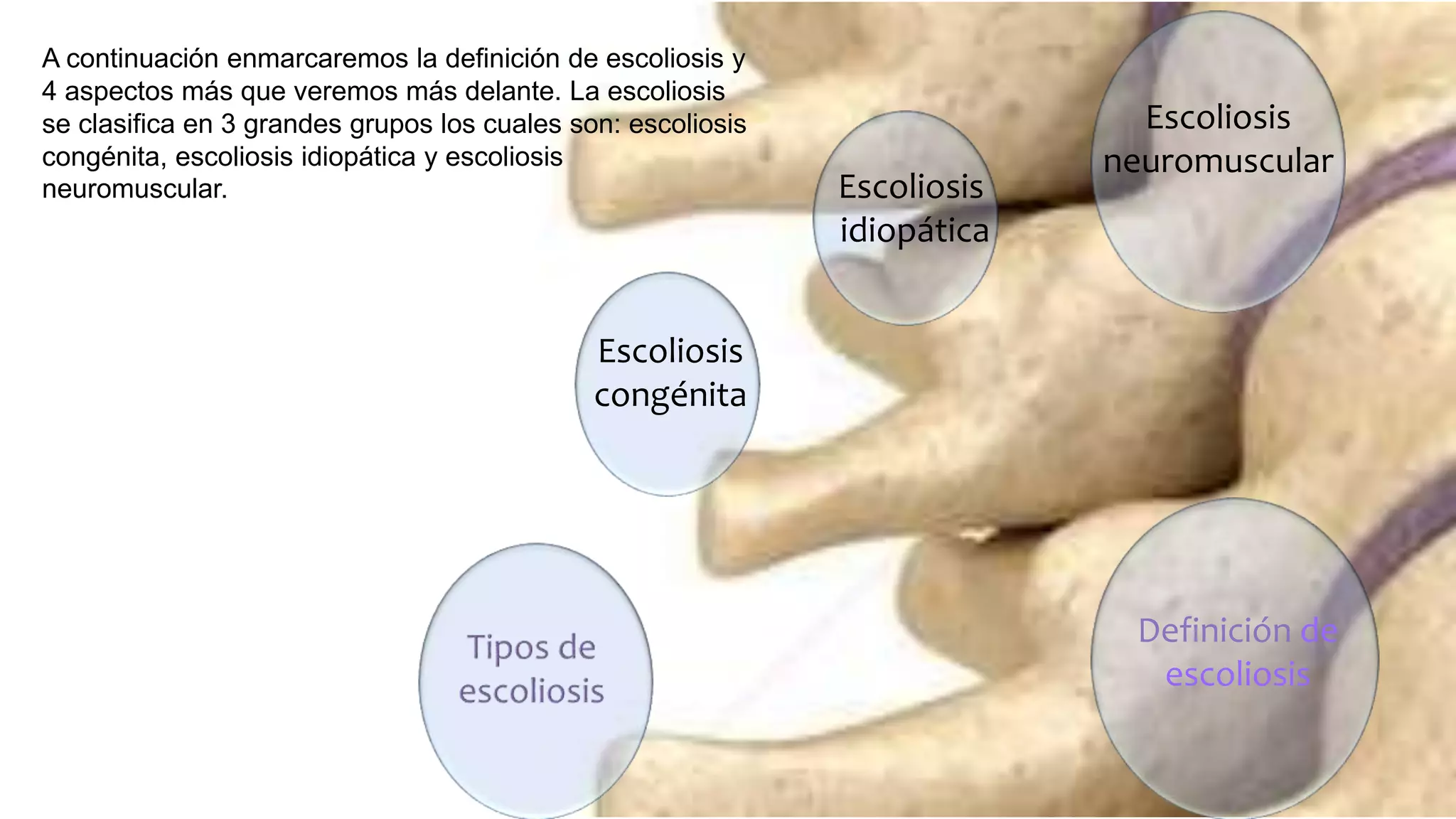 Escoliosis en niños y adolescentes | PPTX
