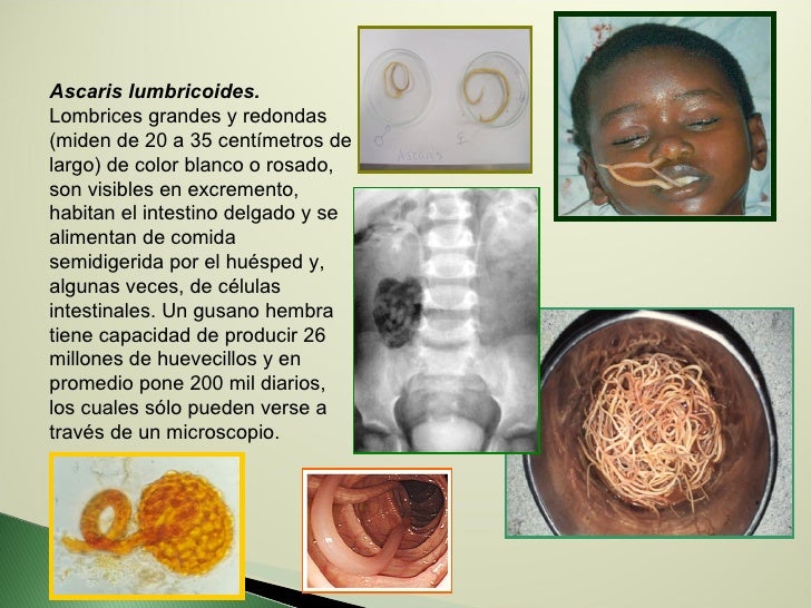 Gusanos Intestinales En Humanos