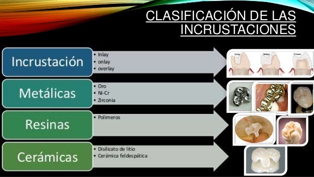 Presentación incrustaciones