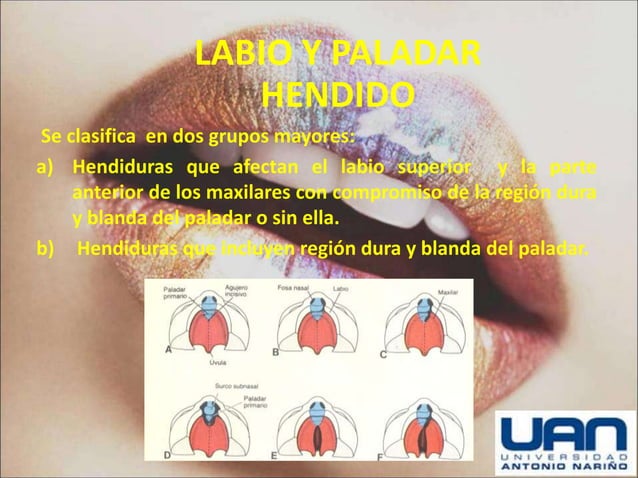 Labios y Paladar (anatomia)normal y fisurado | PPSX