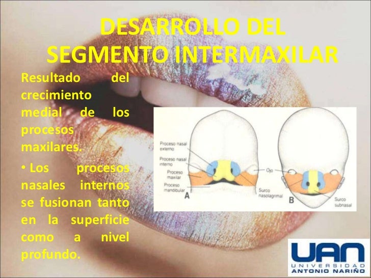 Labios y Paladar (anatomia)normal y fisurado