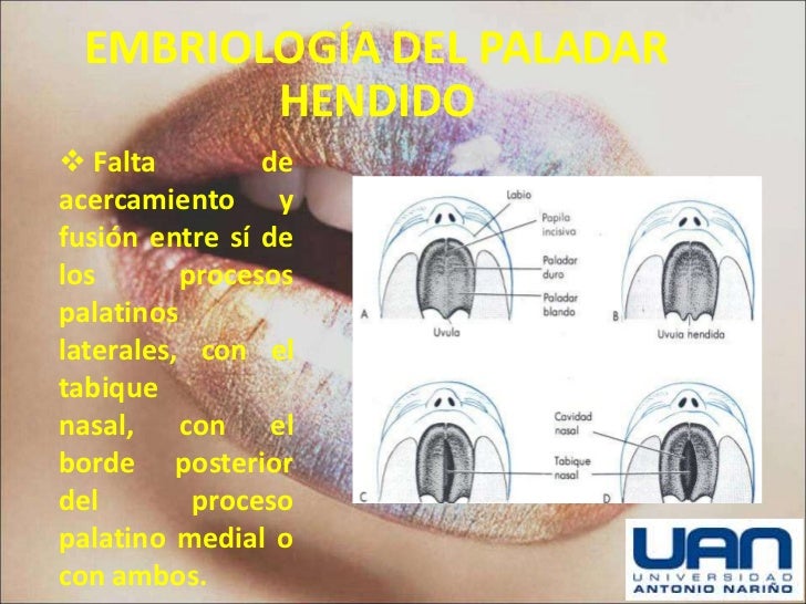 Labios y Paladar (anatomia)normal y fisurado