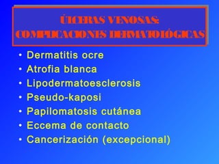 Presentación Úlceras Venosas | PPT