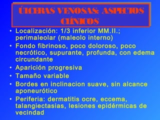 Presentación Úlceras Venosas | PPT