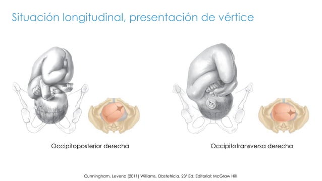 Presentación, posición y situación fetal | PPT