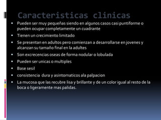 Radiología: Lesiones benignas (En torus palatino) | PPTX