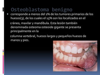 Radiología: Lesiones benignas (En torus palatino) | PPTX