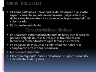 Radiología: Lesiones benignas (En torus palatino) | PPTX