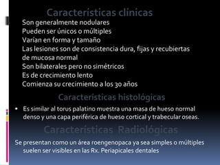 Radiología: Lesiones benignas (En torus palatino) | PPTX