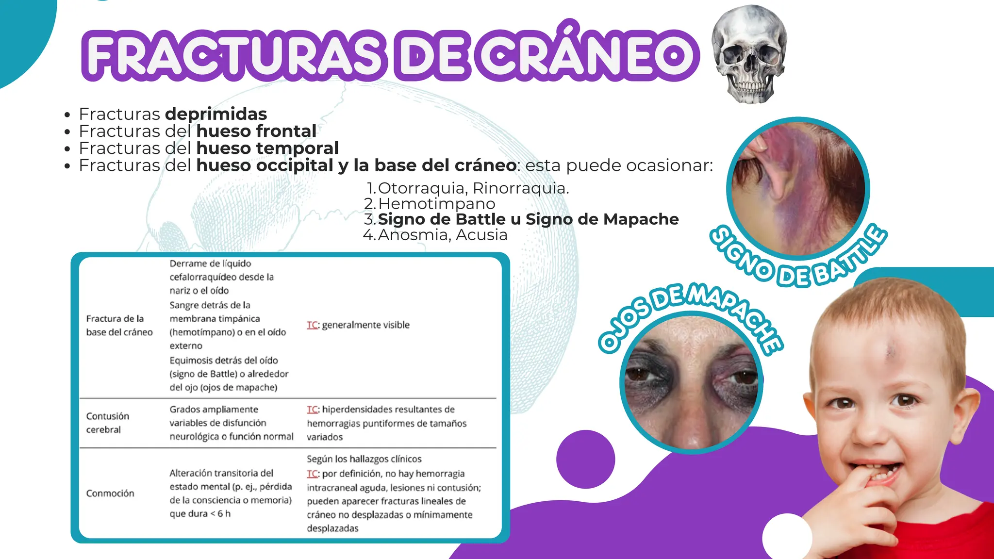 Traumatismo Craneoencefalitoc, HEC, meningitis, Sx comatoso | PDF