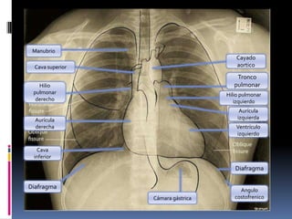 Radiografia de Torax | PPTX