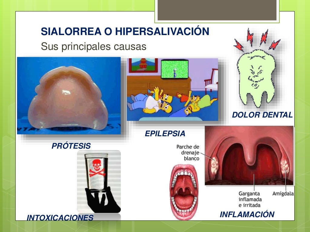 Saliva ComposiciÓn Funciones PatologÍa E Importancia ClÍnica