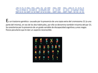SINDROME DE DOWN | PPTX