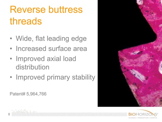 Presentaciòn sistema de implantes biohorizons | PPTX | Dental Health ...