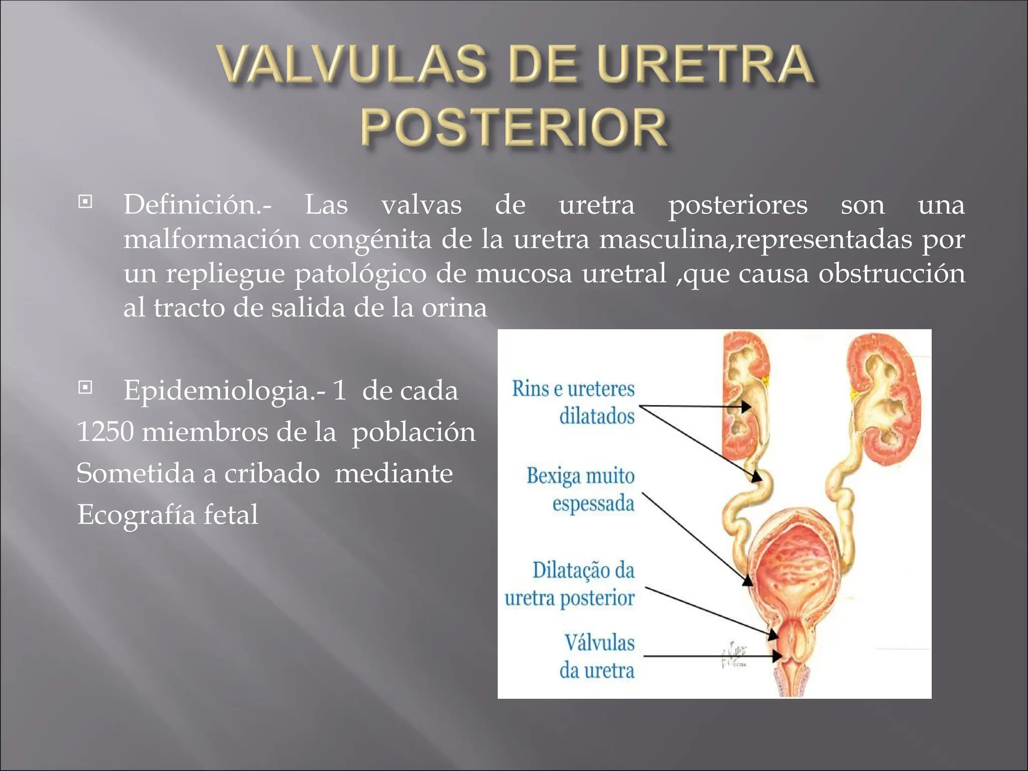 Presentacion de urocele en plenario medico | PPT