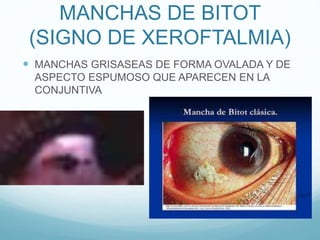 Evaluación Clínica del estado Nutricional | PPT