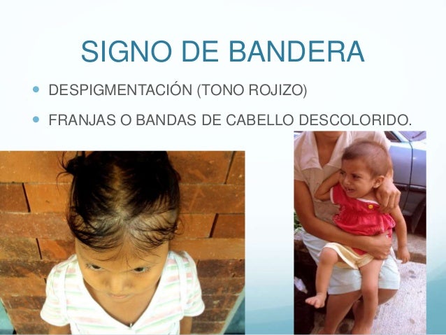 Evaluación Clínica del estado Nutricional