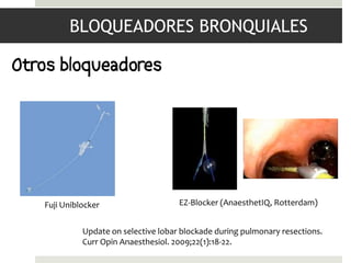 Técnicas de aislamiento pulmonar | PPTX