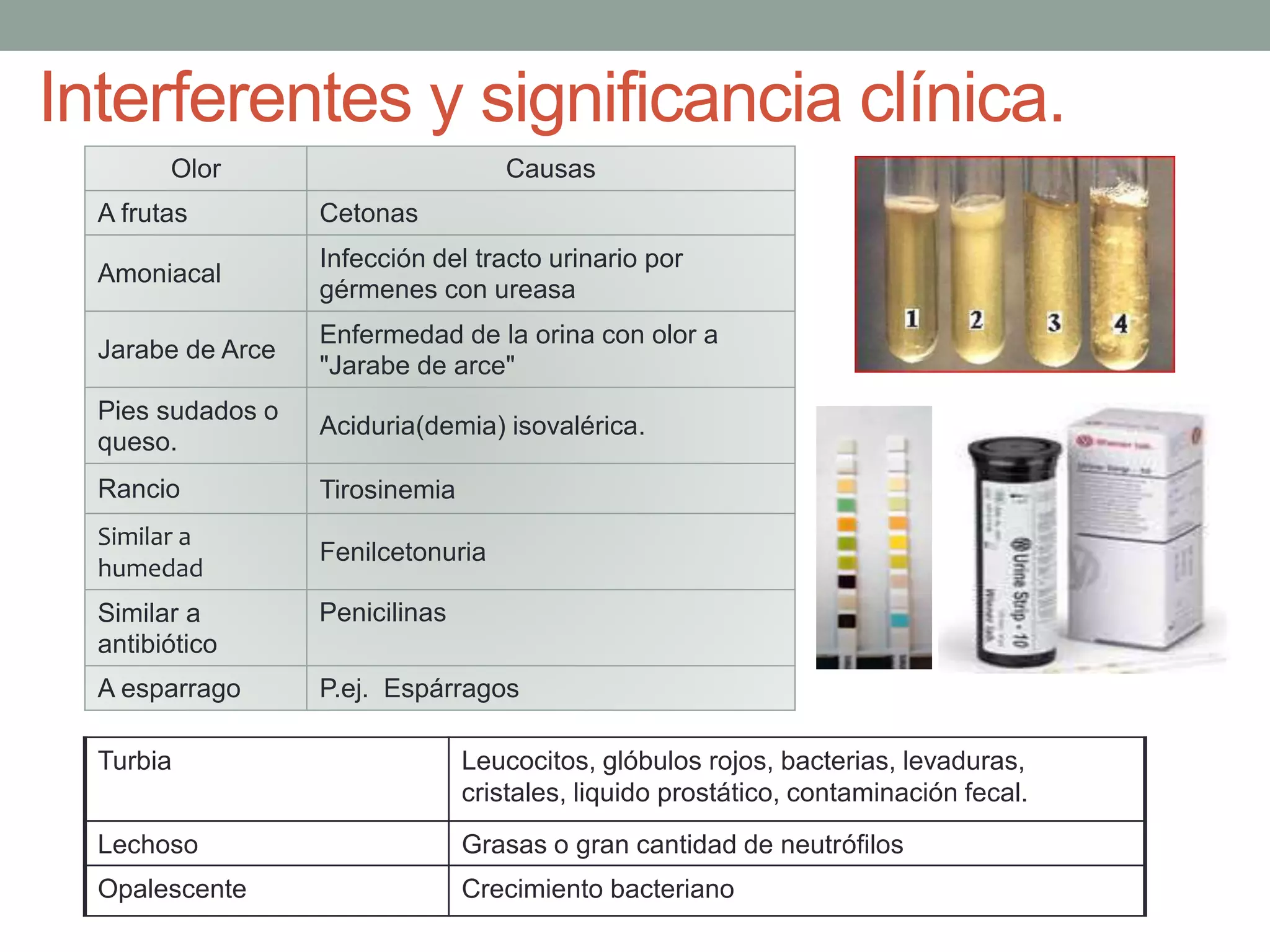 Presentacion analisis fisico de la orina | PPTX