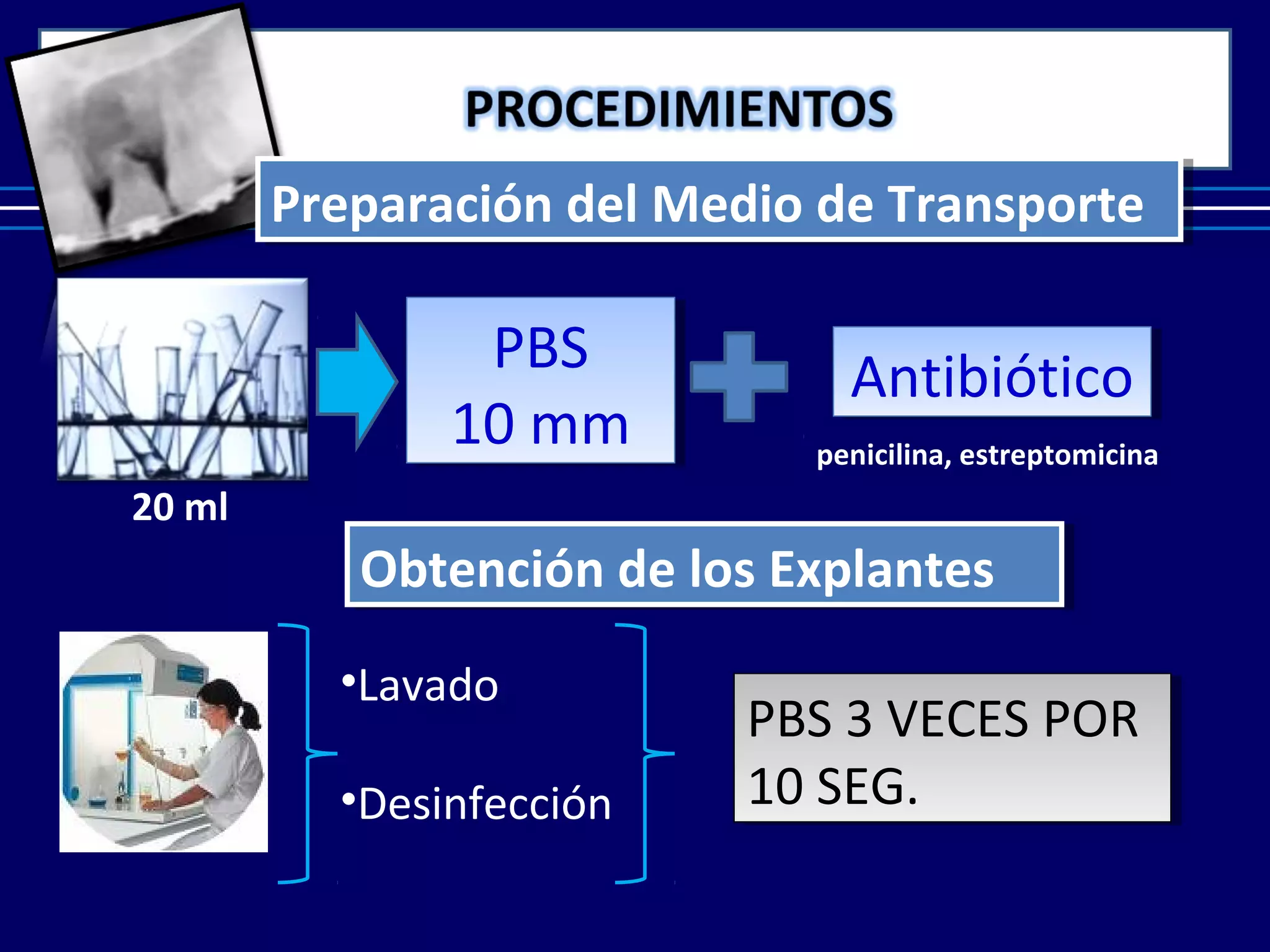 Expresión del RANKL en células del Ligamento Periodontal durante la ...