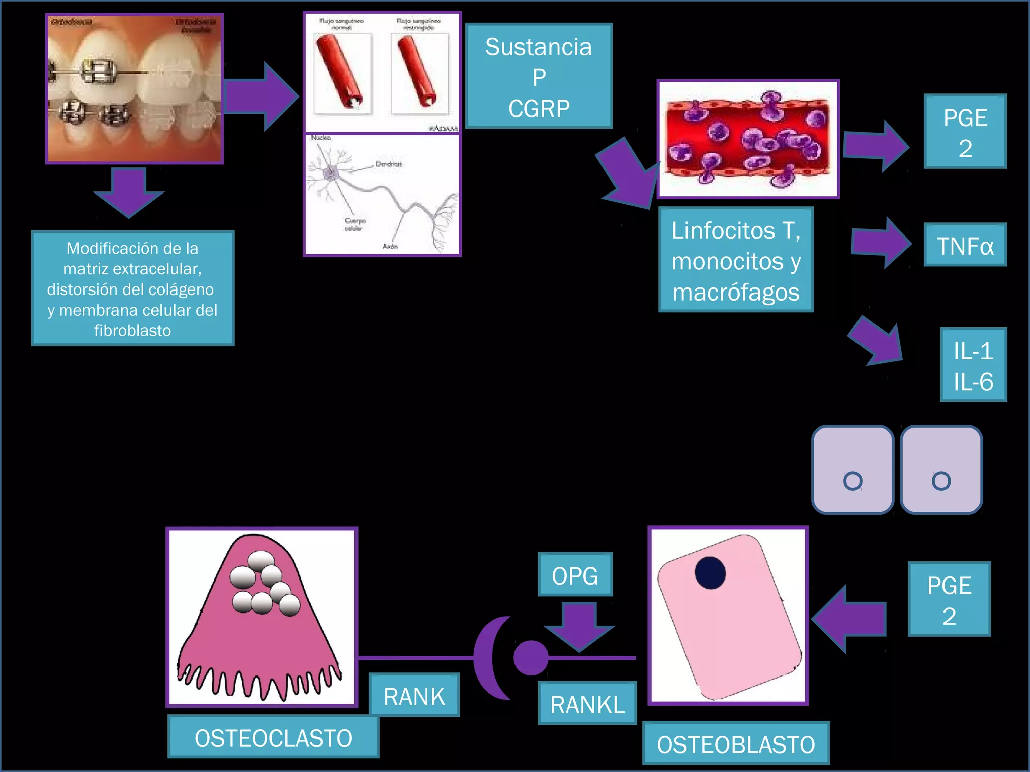 Expresión del RANKL en células del Ligamento Periodontal durante la ...
