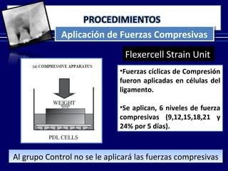 Expresión del RANKL en células del Ligamento Periodontal durante la ...