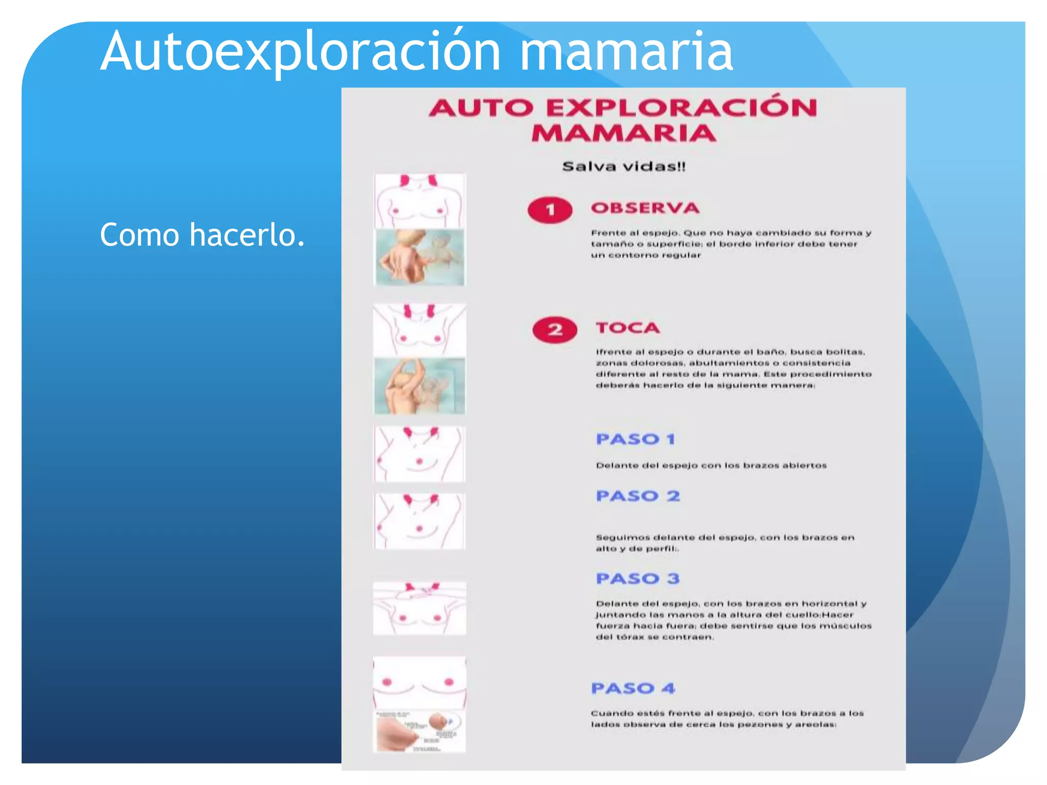 Presentacion autoexploracion mamaria | PPTX