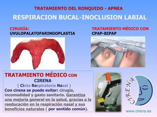 Presentacion beneficios cirena tv saber vivir | PPT