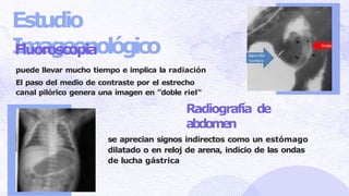 Estenosis hipertrofica del piloro en cirugía pediatrica y su manejo | PPTX