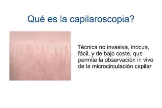 Capilaroscopia en AP | PPT
