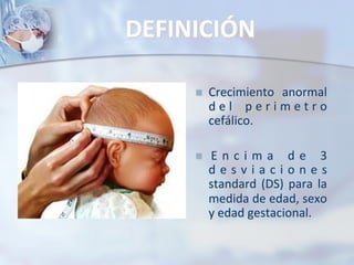 Presentación caso clínico de lactante con macrocefalia | PDF