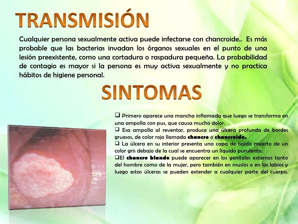 Presentacion chancro blando tarea siso
