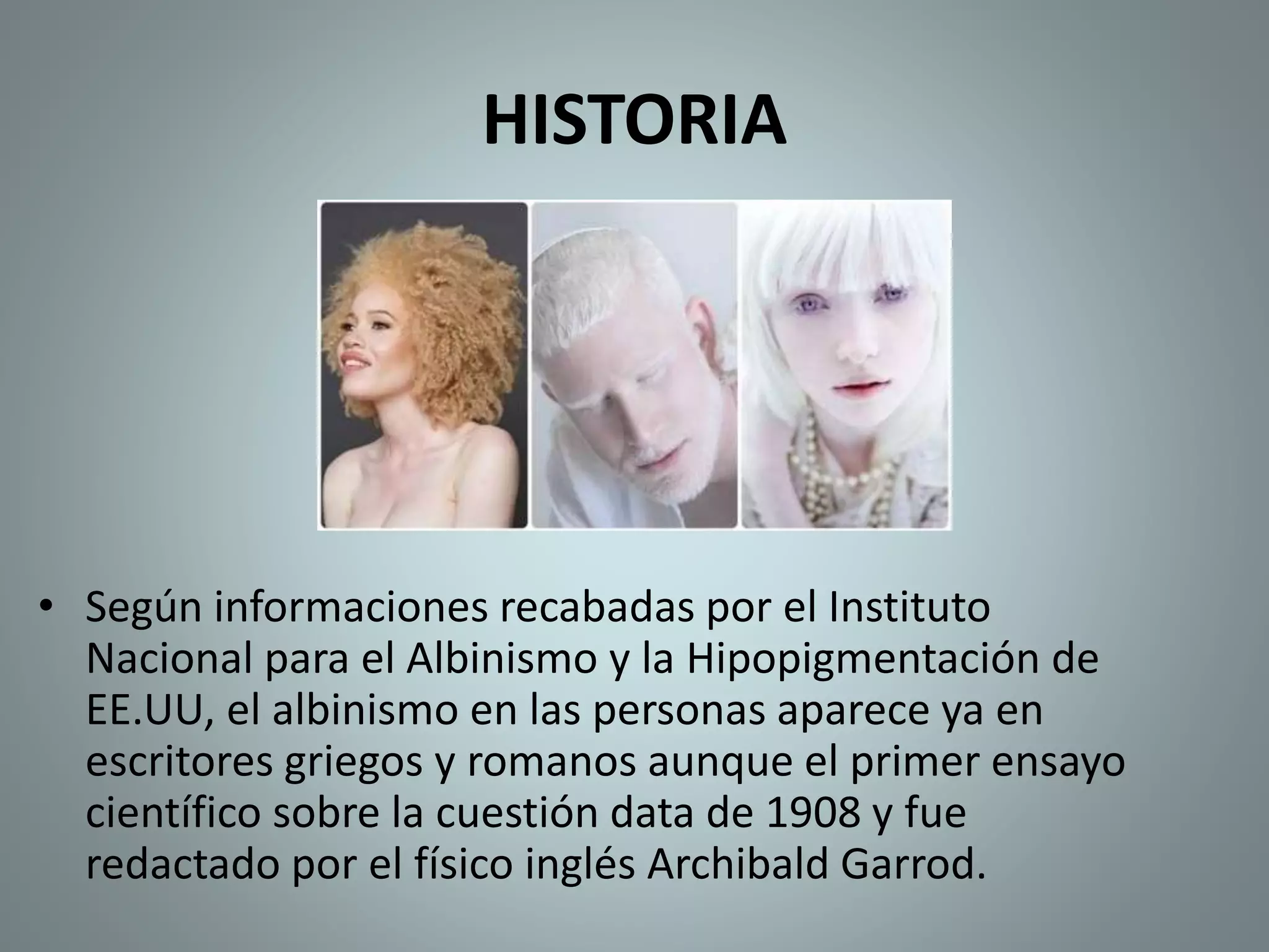 Presentacion sobre el albinismo | PPTX