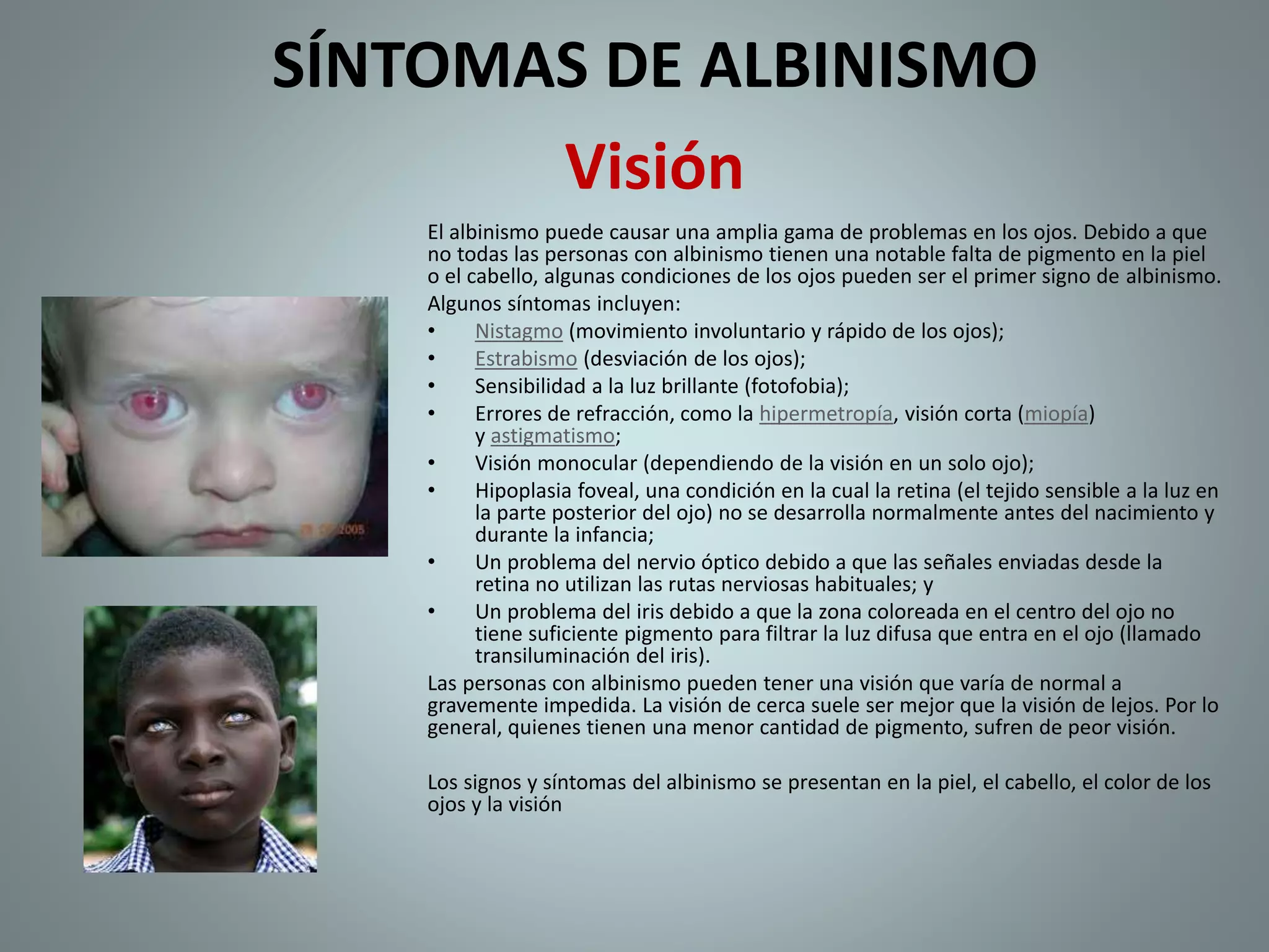 Presentacion sobre el albinismo | PPTX