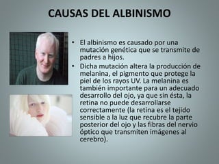Presentacion sobre el albinismo | PPTX