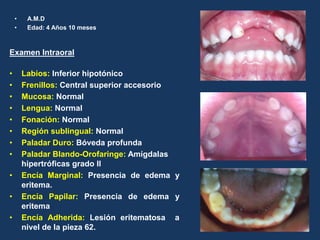 Presentacion de caso odontopediatria paciente tratado bajo sedacion ...