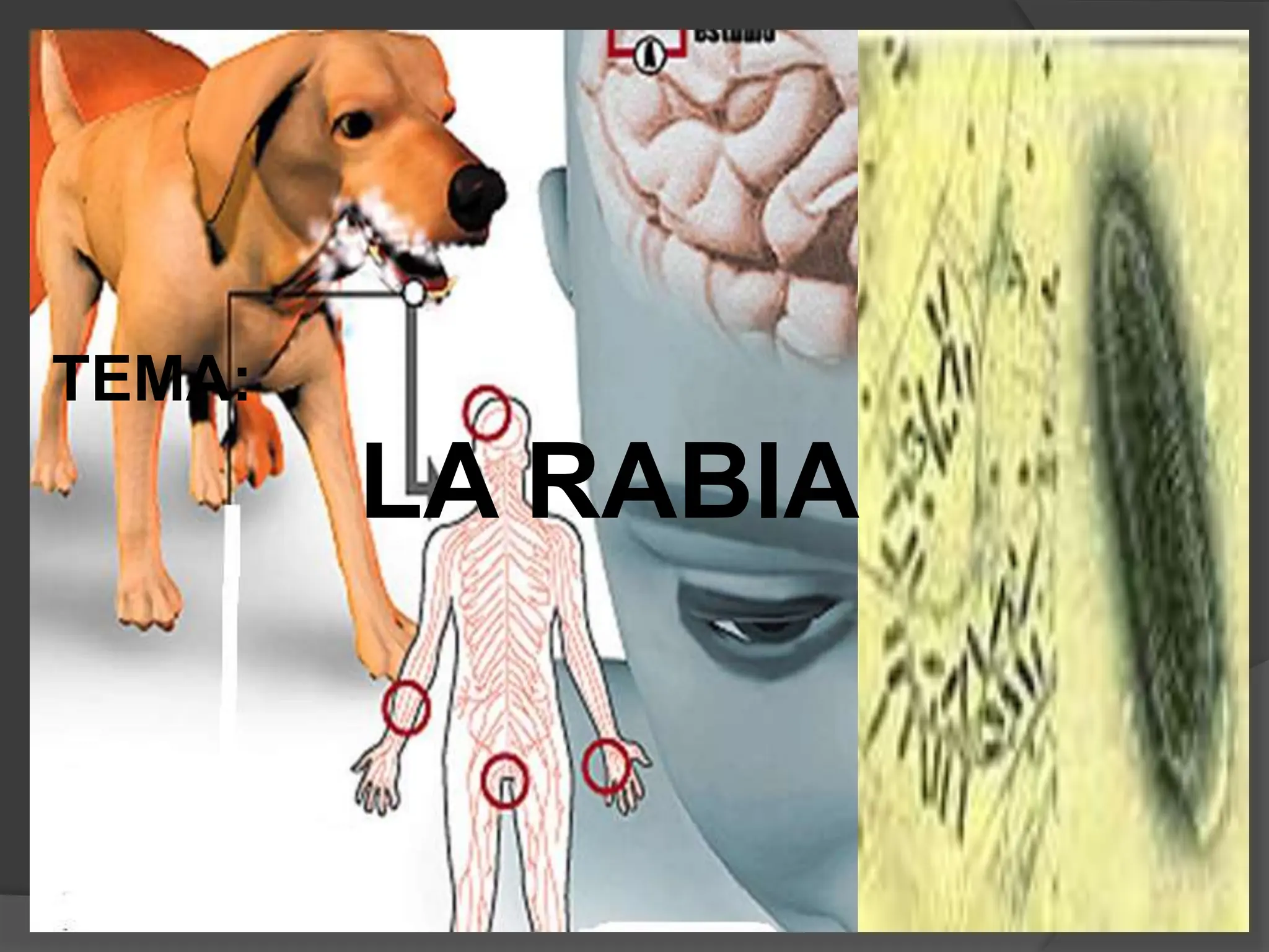 PRESENTACION DE LA RABIA.pptx