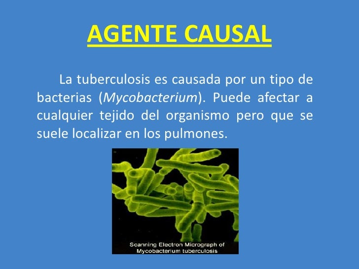 Presentacion De La Tuberculosis 1