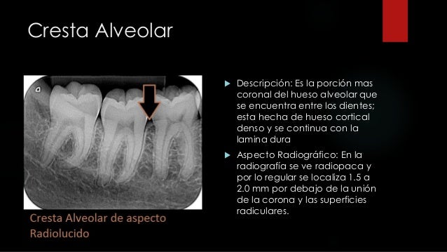 Radiologia Dental Haring Jansen- Capitulo 26